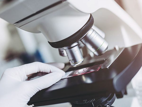 Optimisation of Diagnostic Specimen Collection Network - Akeso
